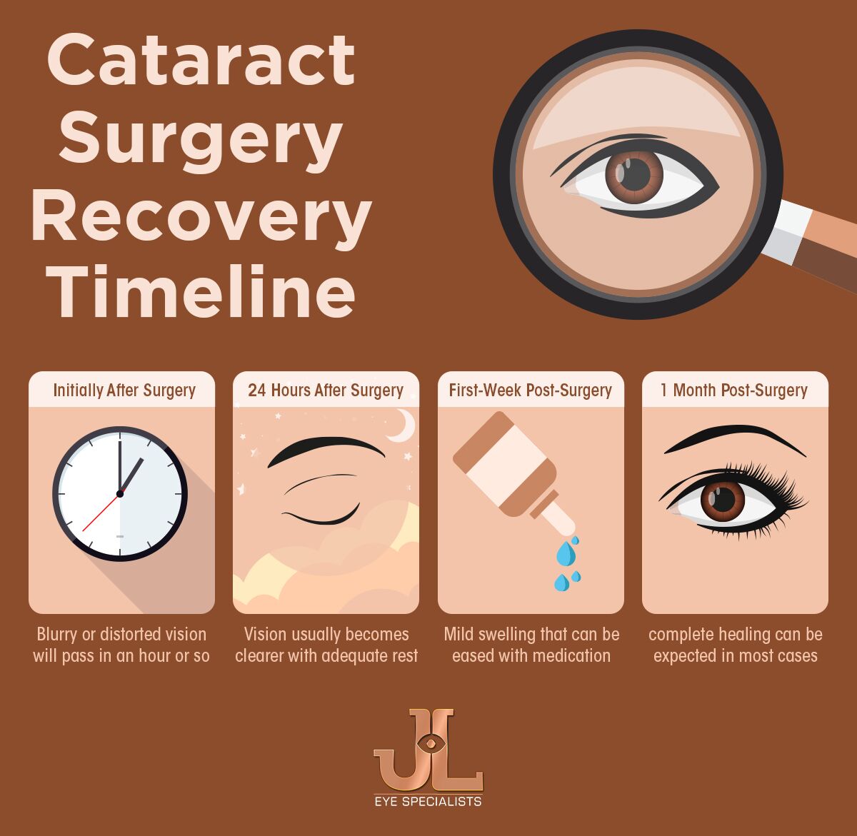 cataract surgery recovery